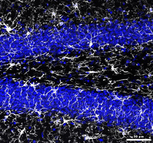 Hay Fever Affects Immune Cells in the Brain and the Formation of New ...