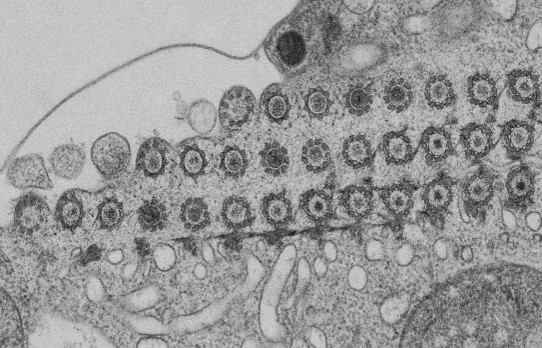 New Phylogenetic Features in Oligotrichea (Ciliophora) - Universität ...