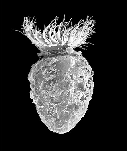 A Revision of Aloricate Oligotrichea (Ciliophora, Spirotricha), a Group ...